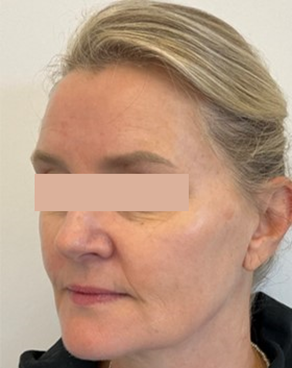 Prisma – A Full Spectrum Approach